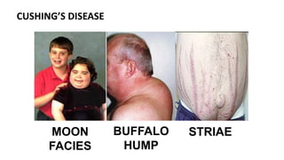 Benign and Malignant Endocrine Disorders | PPTX