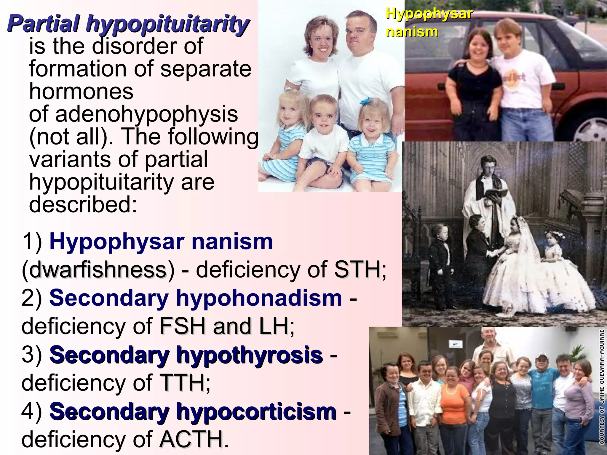 Pathophysiology of the endocrine system. General adaptation syndrome ...