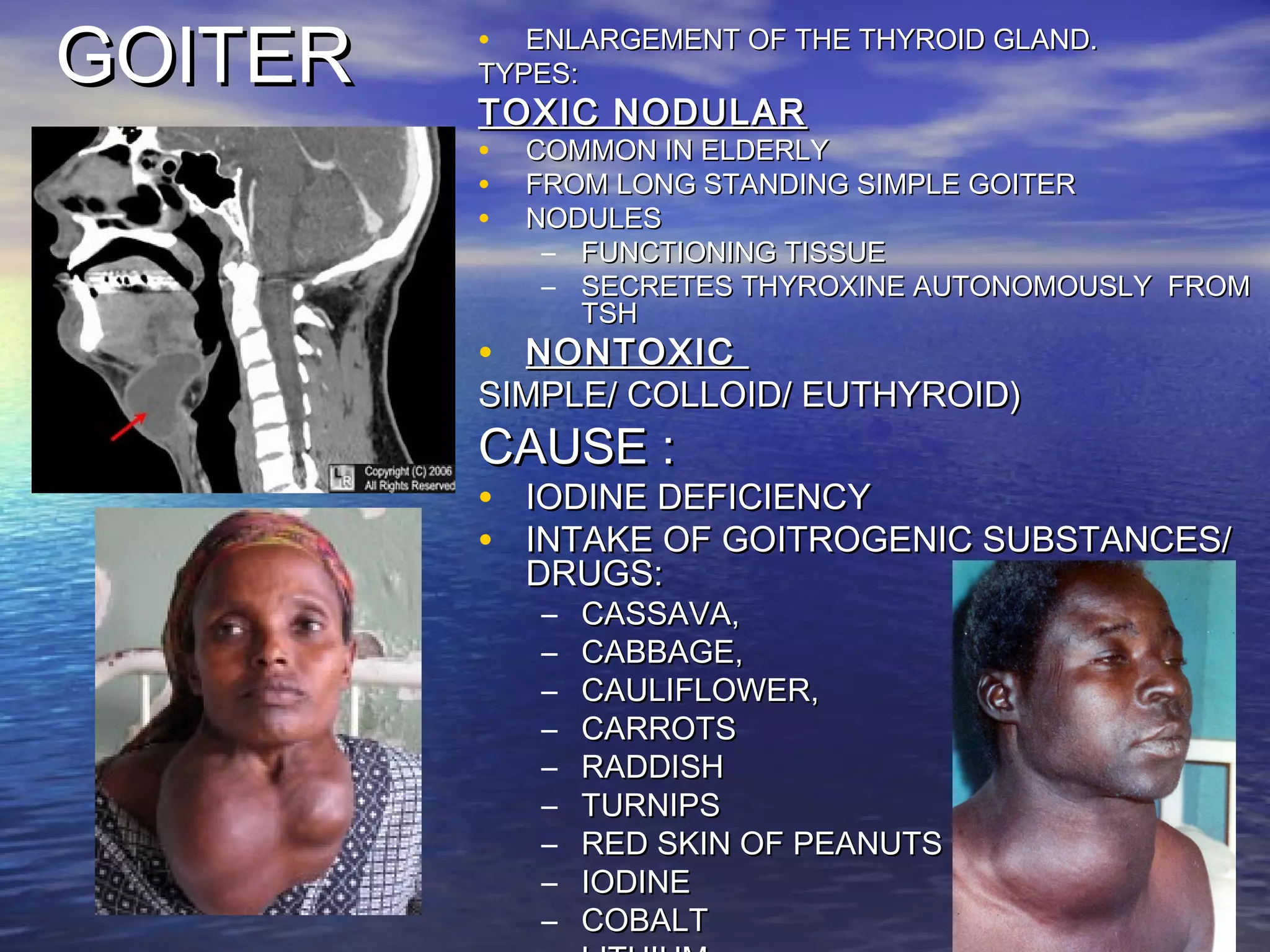 Pathophysiology of the thyroid, parathyroid and sexual glands | PPT