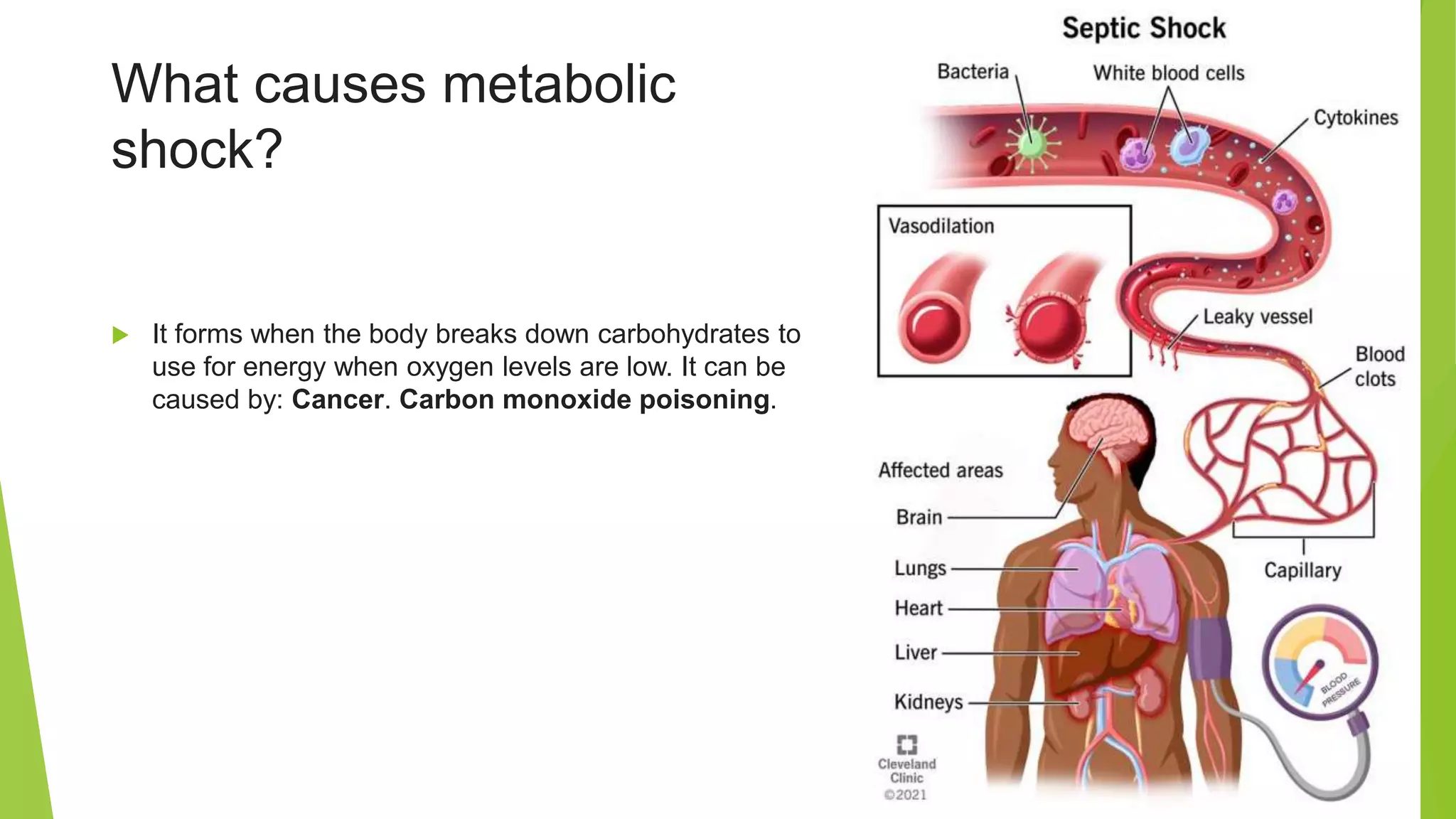 Endocrine and metabolic shock.pptx | Thyroid Disorders | Endocrine and Metabolic Diseases
