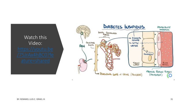 ENDOCRINE ASSESSMENT.pptx | Endocrine and Metabolic Diseases | Diseases ...