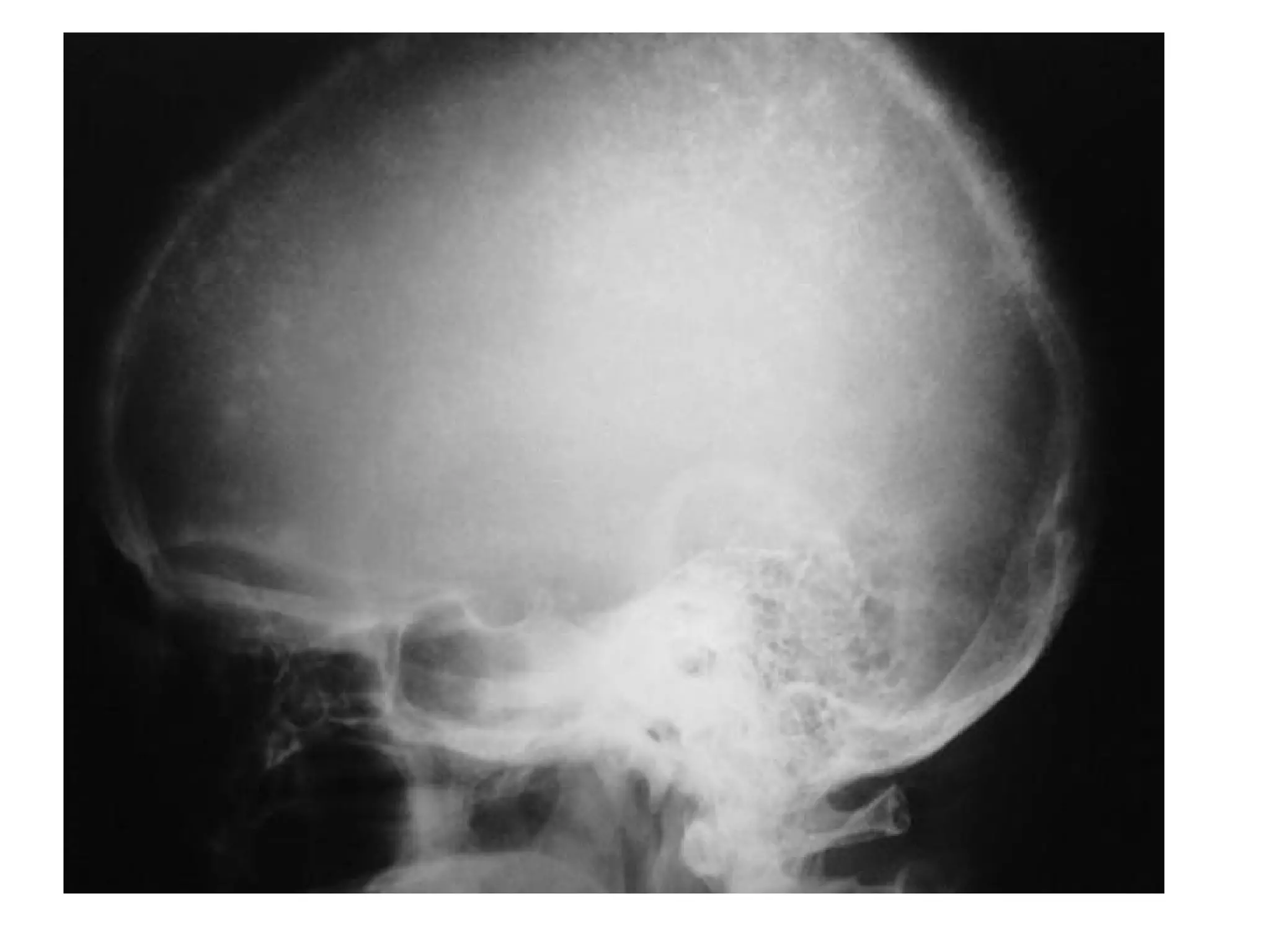Diagnostic Imaging of Endocrine bone disease | PPT