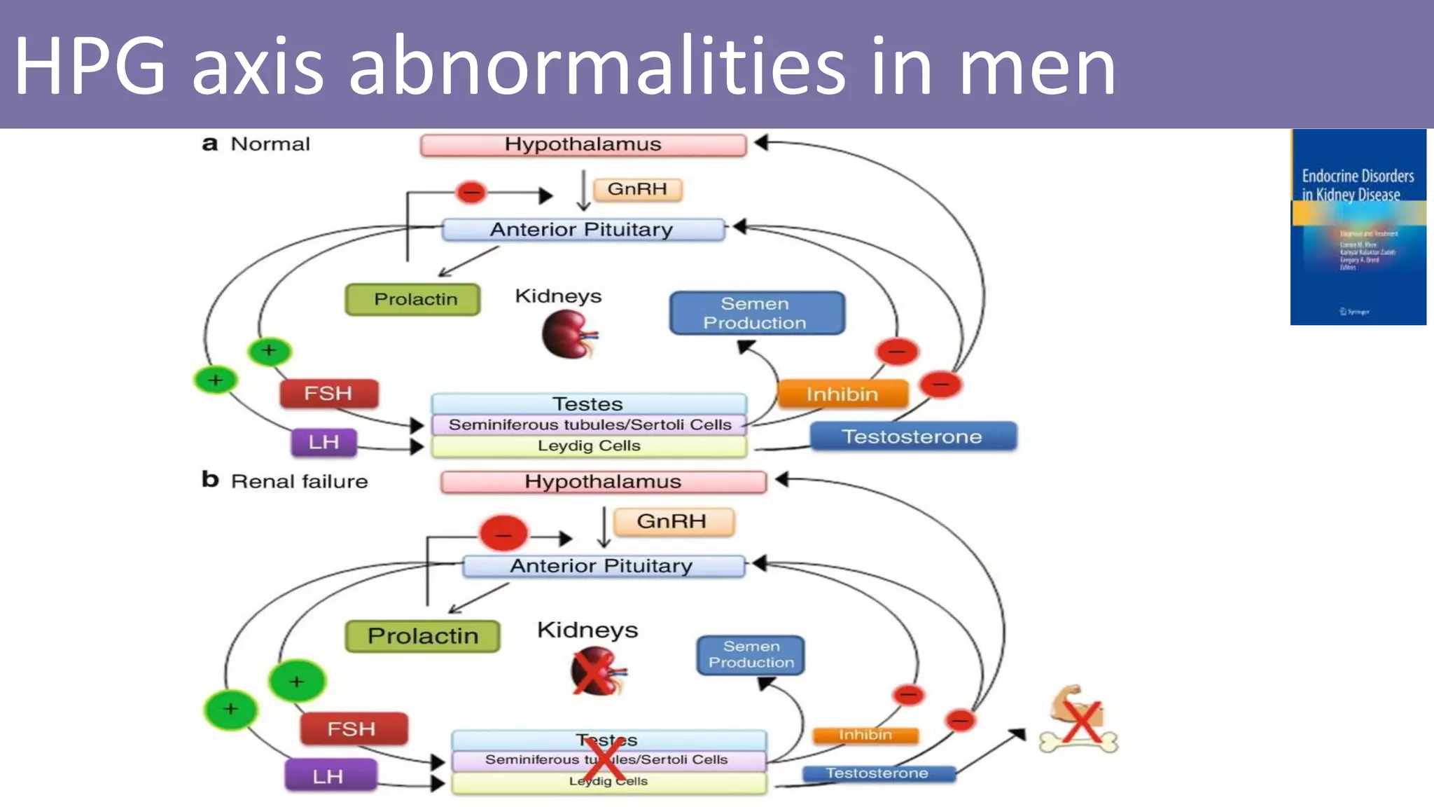 Endocrine disorders in CKD | PPTX