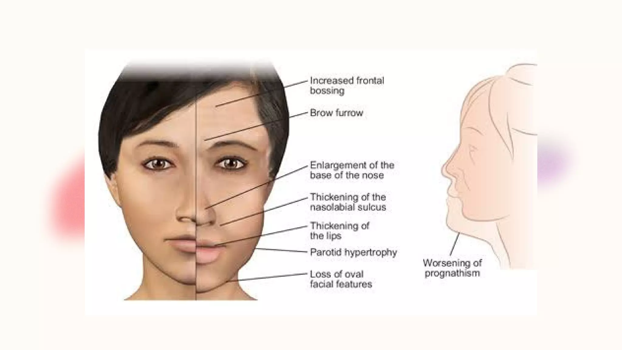 Endocrine Disorders.pdf