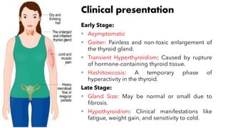 Endocrine disorders.internal medicine xp | PDF