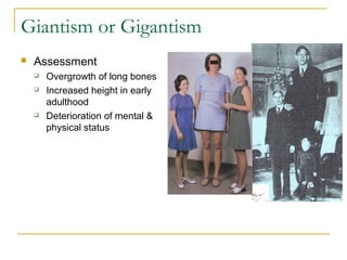 Endocrine Disorders (Pituitary) | PPT