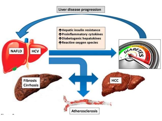Endocrine dysfunction in cld | PPTX