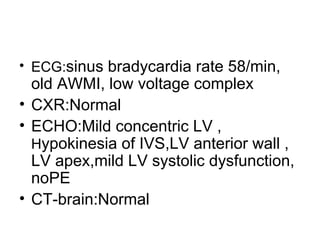 A Case of Myxedema Crisis | PPT