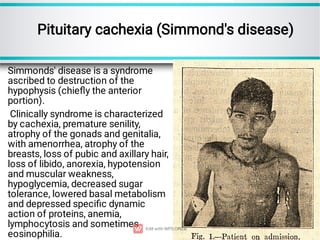 endocrine glands — копия.pdf