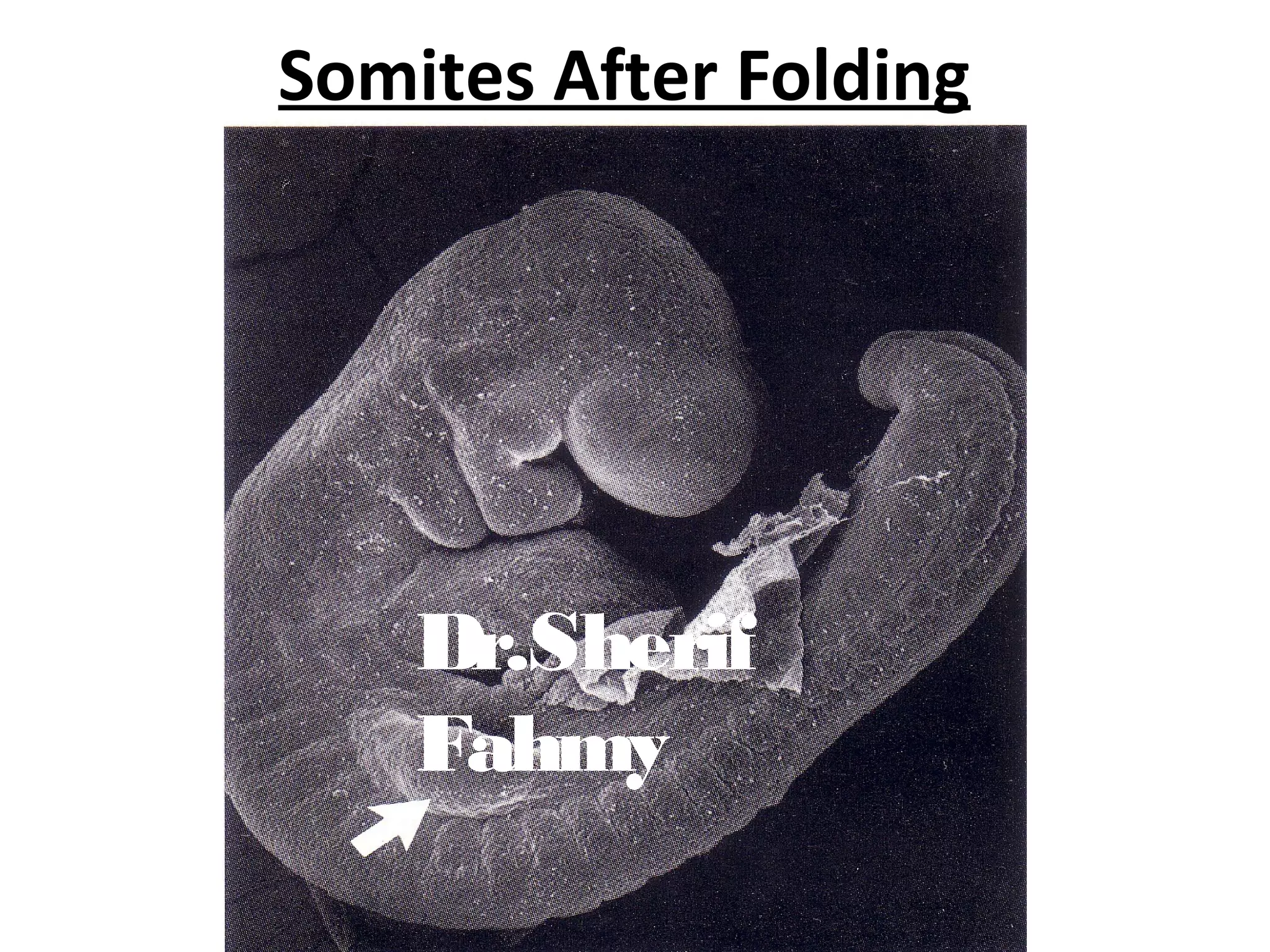 Development of Endocrine glands & Muscles (Special Embryology) | PPS