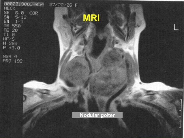 Investigation of endocrine glands