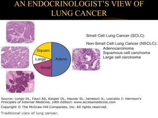 Endocrine manifestations of lung cancer and its management | PPT