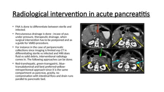 Endocrine pancreas /computerized Tomography and MRI | PPT