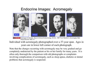 Images of Endocrine Disorders | PDF