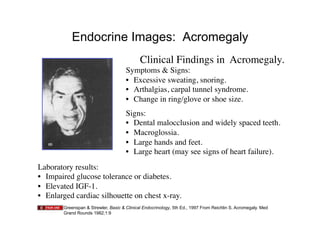 Images of Endocrine Disorders | PDF