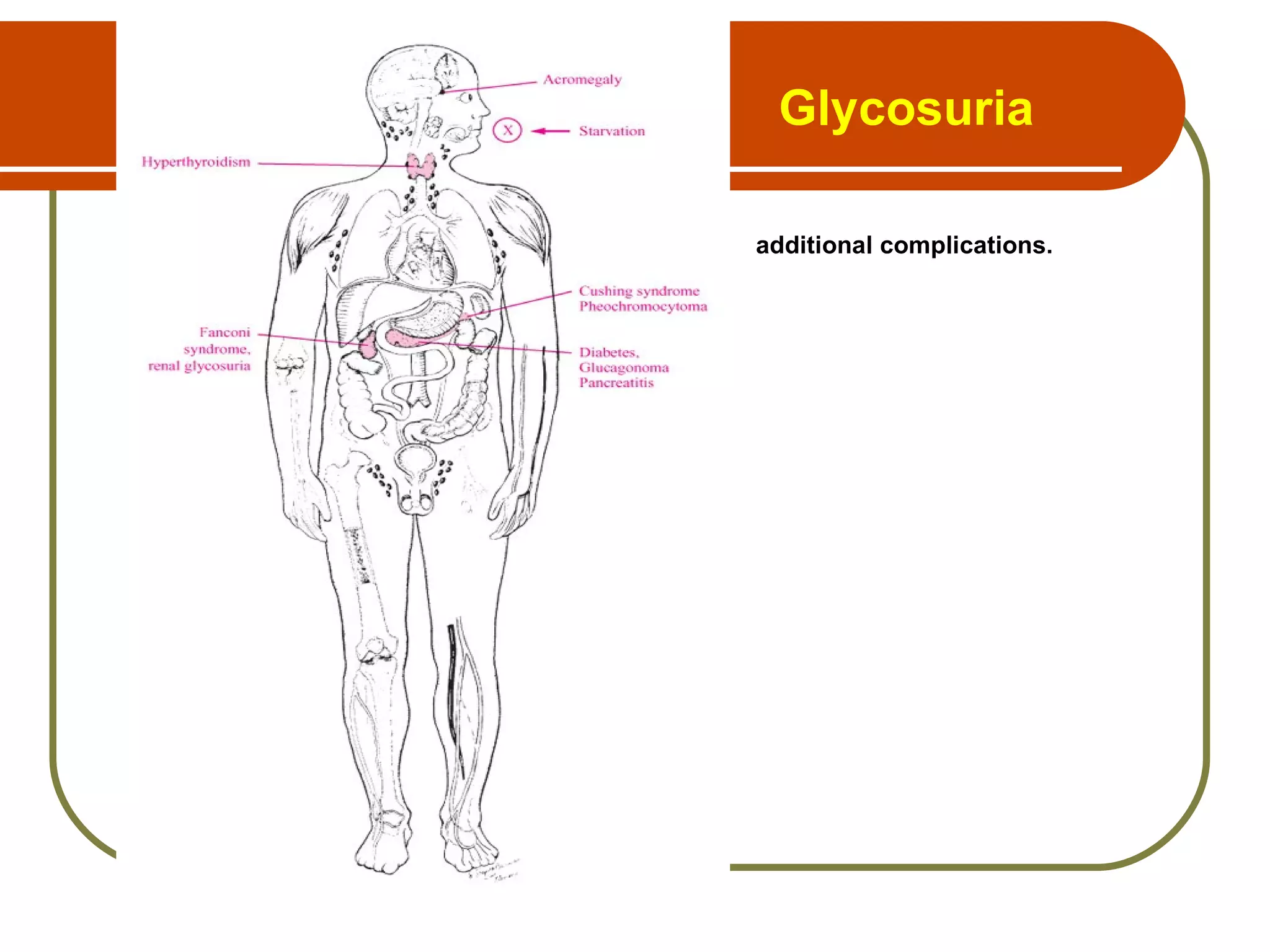 Endocrine Sys. (Hypercalcemia) | PPT
