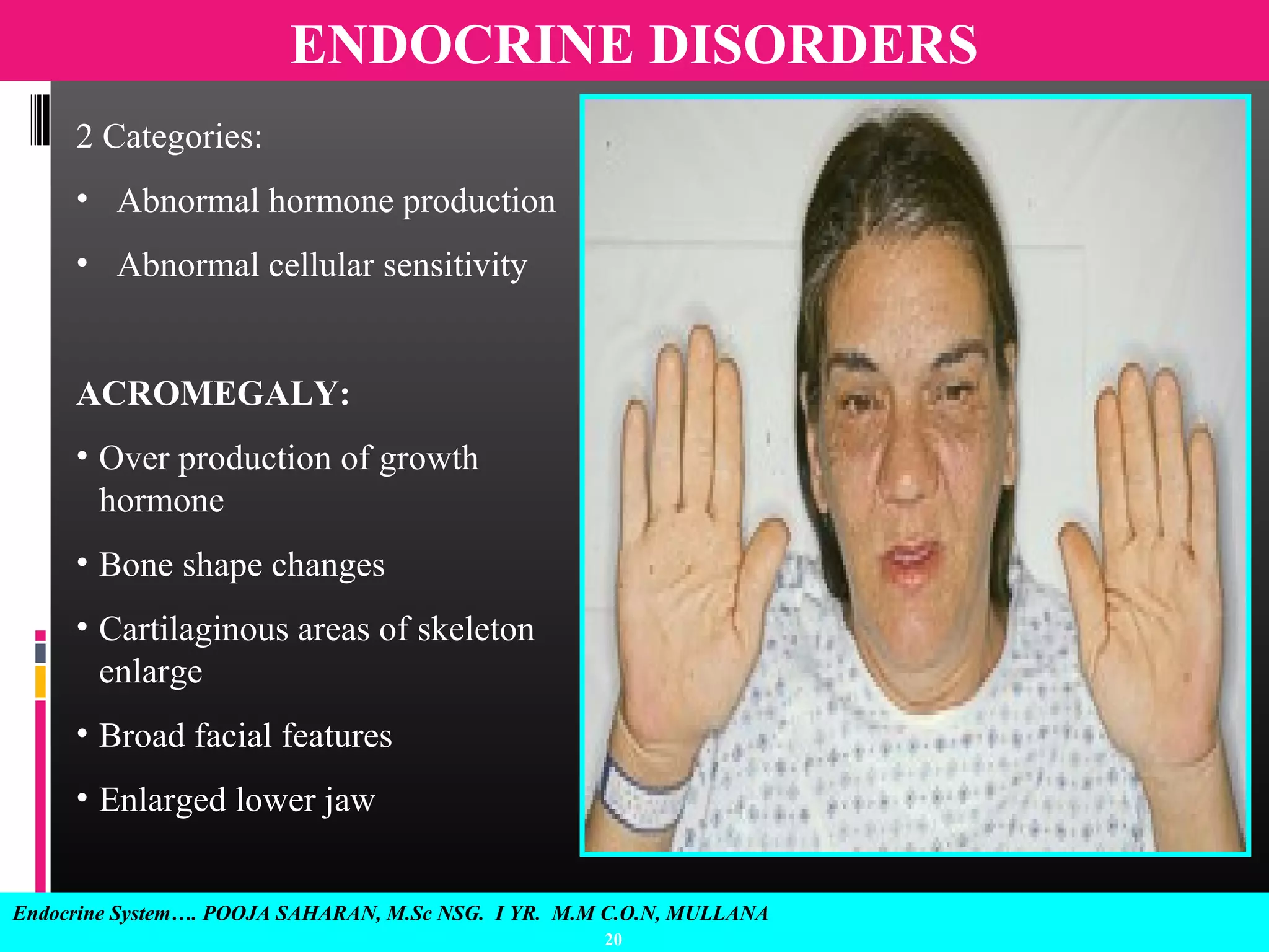 Endocrine system | PPT