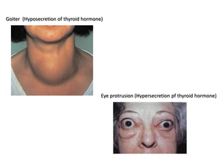Endocrine system | PPTX