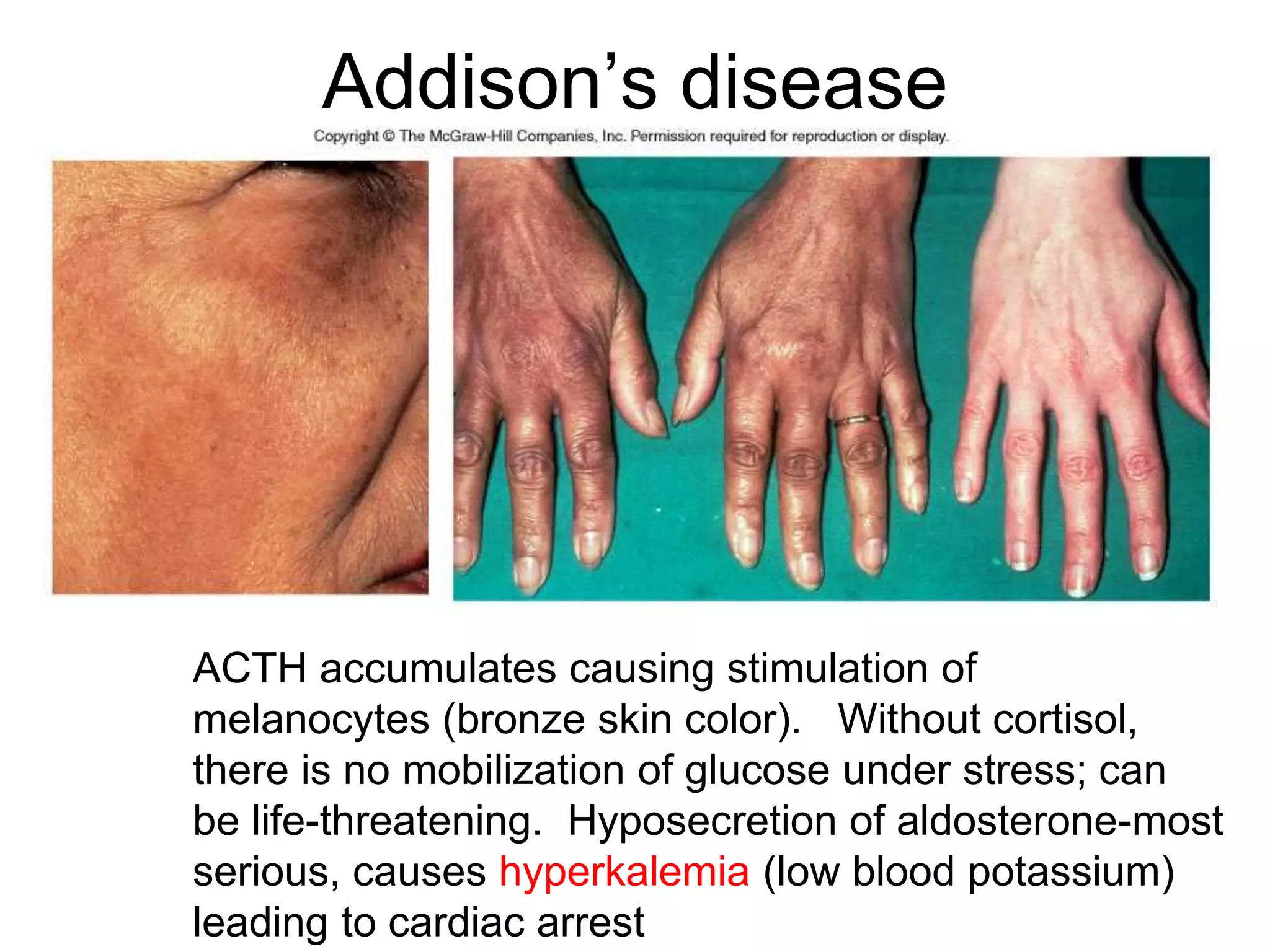 Endocrine System.ppt