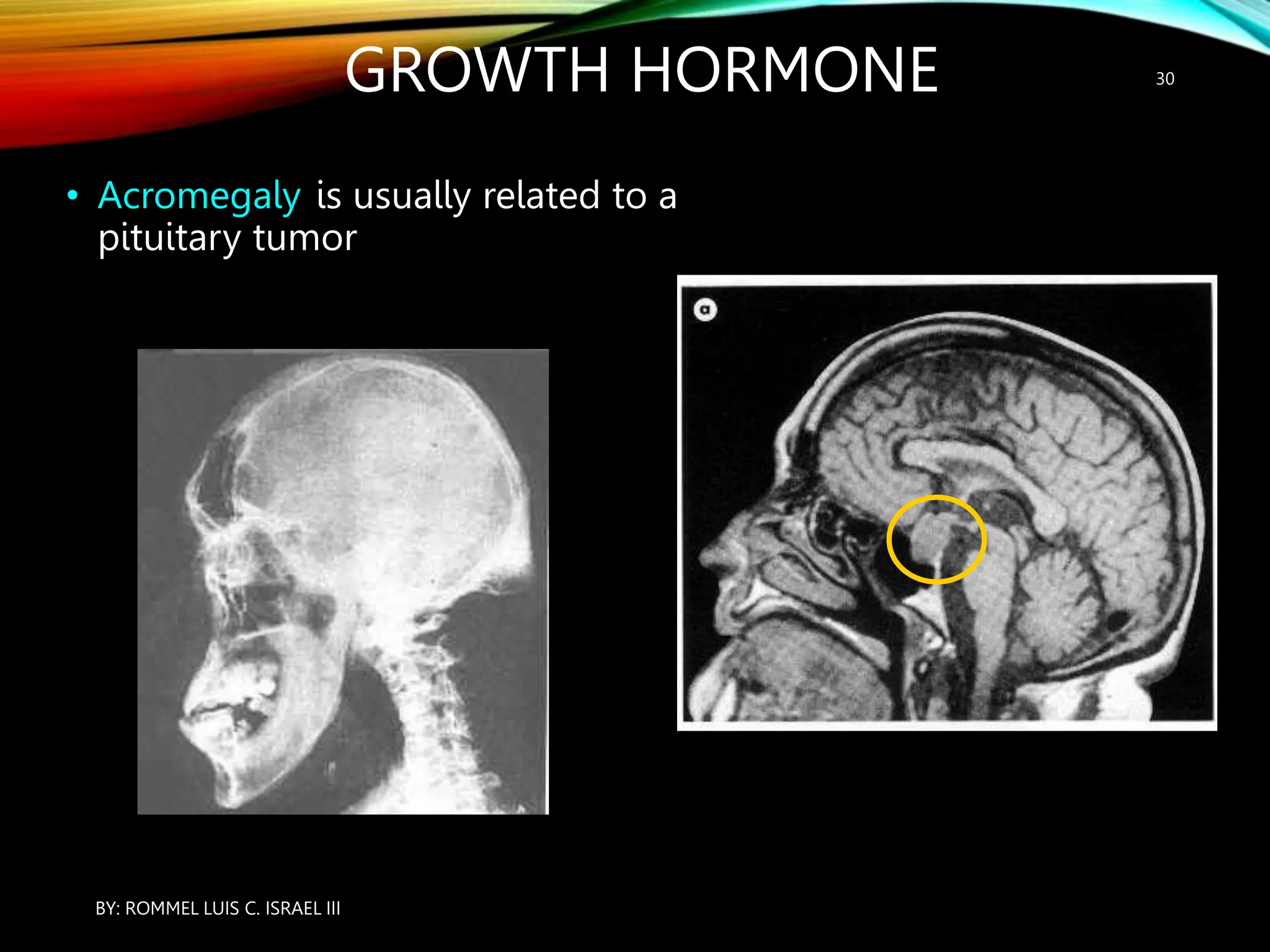 ENDOCRINE SYSTEM - ANATOMY AND PHYSIOLOGY | PPT