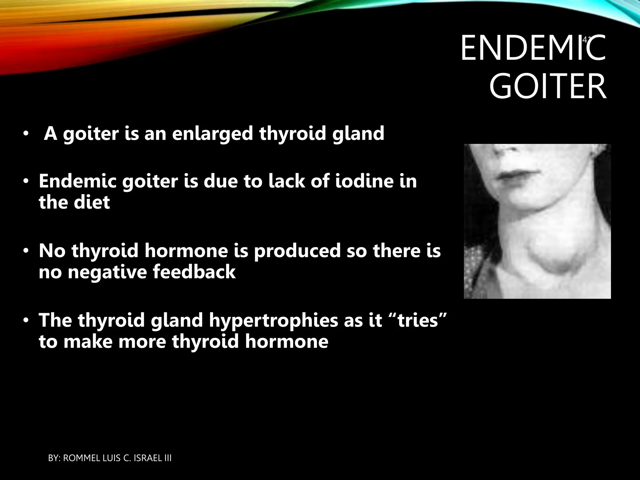 ENDOCRINE SYSTEM - ANATOMY AND PHYSIOLOGY | PPT
