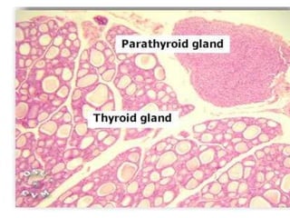 Parathyroid Gland Slide