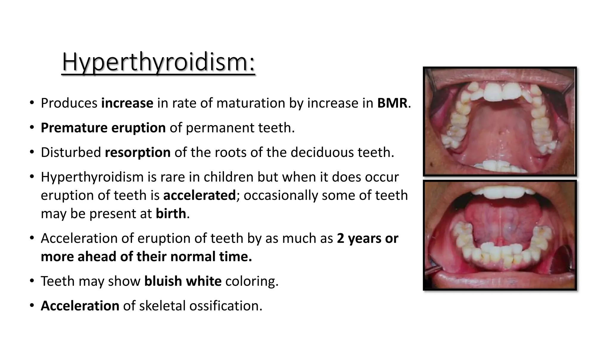 ENDOCRINE SYSTEM ORTHODONTICS.pptx