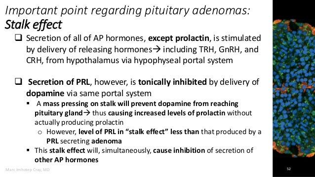 Endocrine System Pathology_ Ppt Lecture Series (5 in 1)