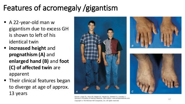 Endocrine System Pathology_ Ppt Lecture Series (5 in 1)