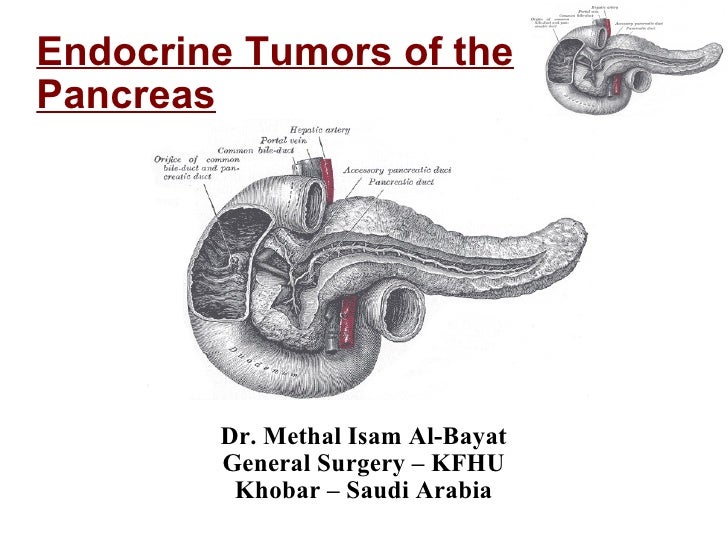 Endocrine Tumors Of The Pancreas