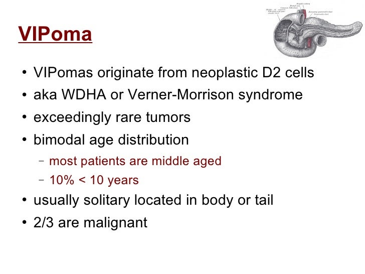 Endocrine Tumors Of The Pancreas