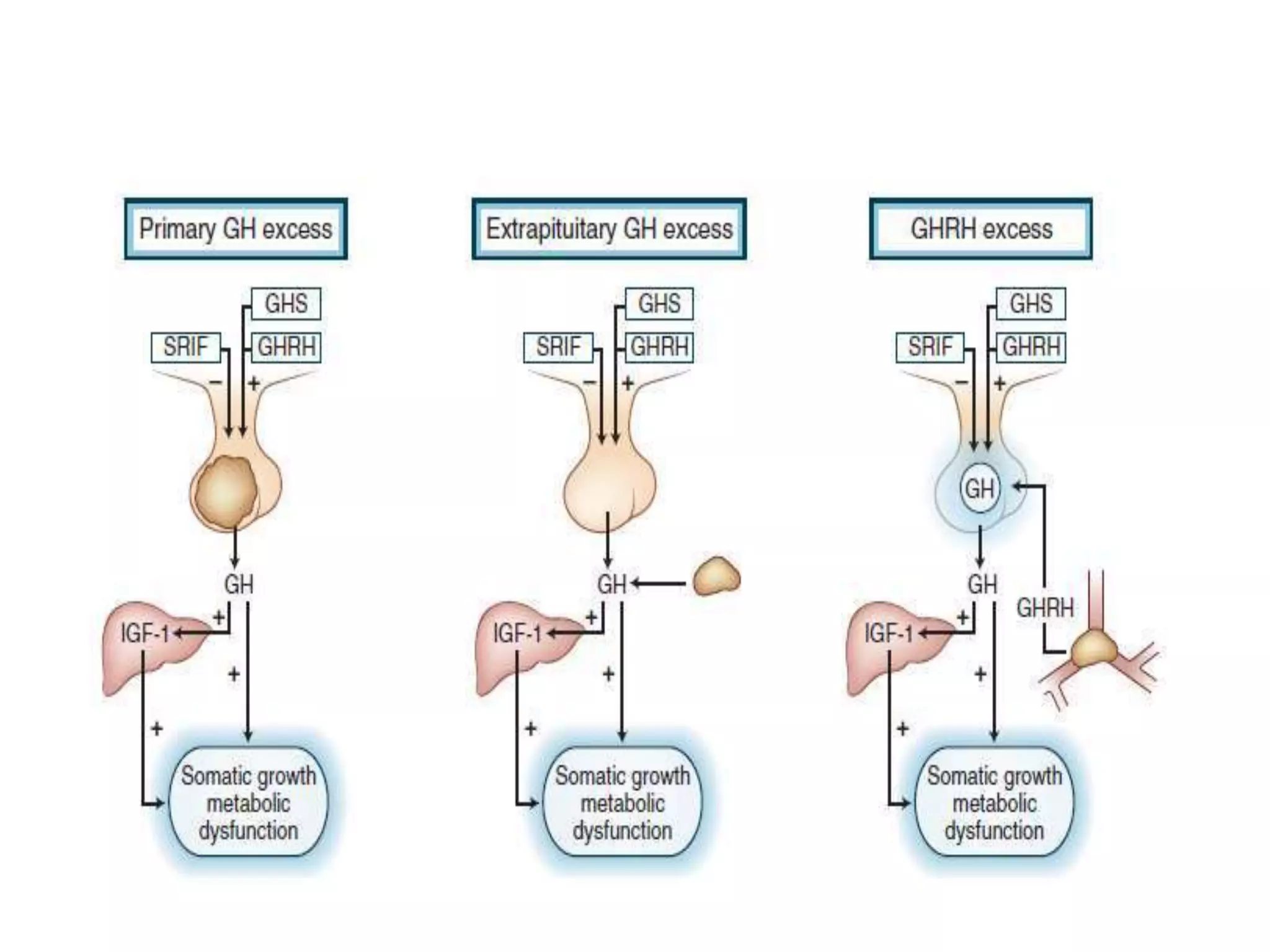 Acromegaly | PPTX | Endocrine and Metabolic Diseases | Diseases and ...