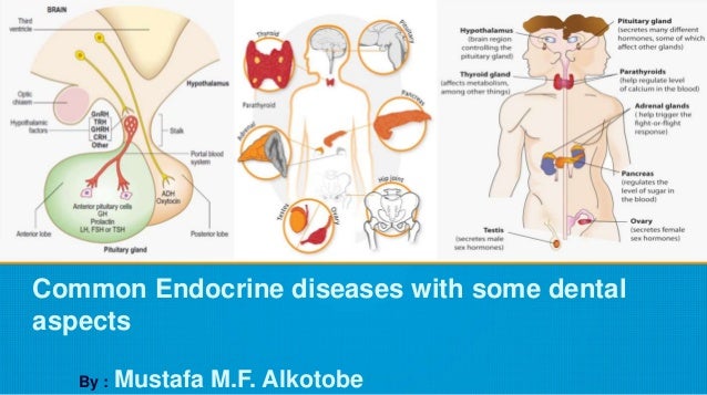 Endocrine Disorders