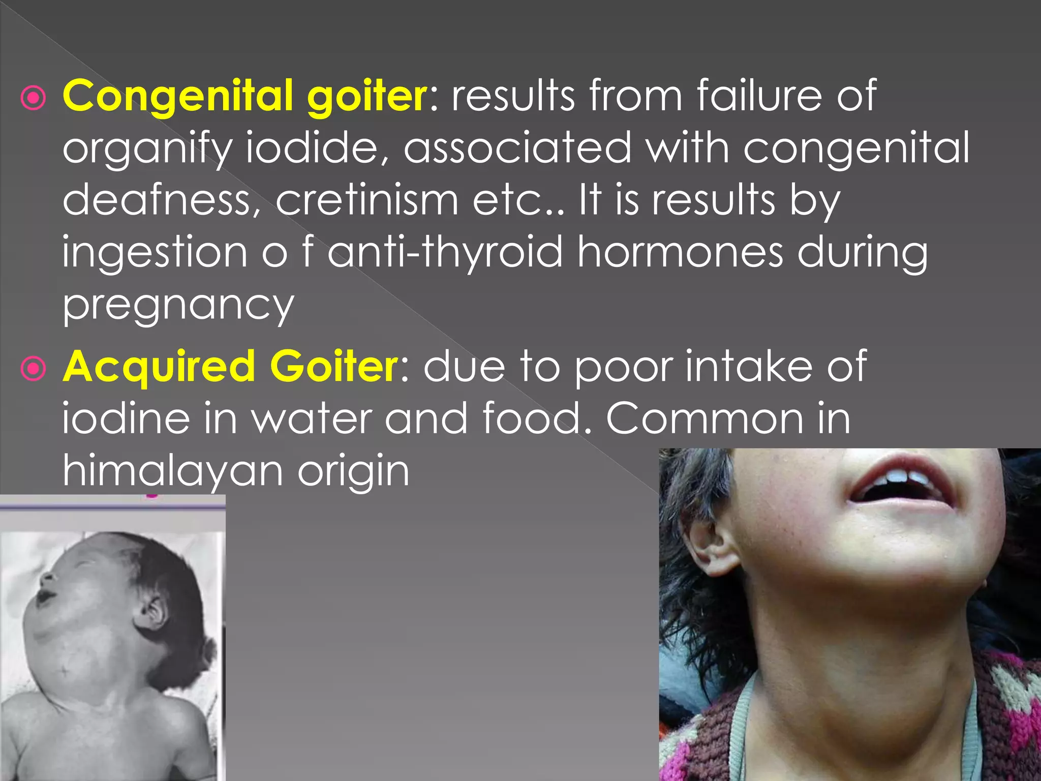disorders of Endocrine in Children | PPTX