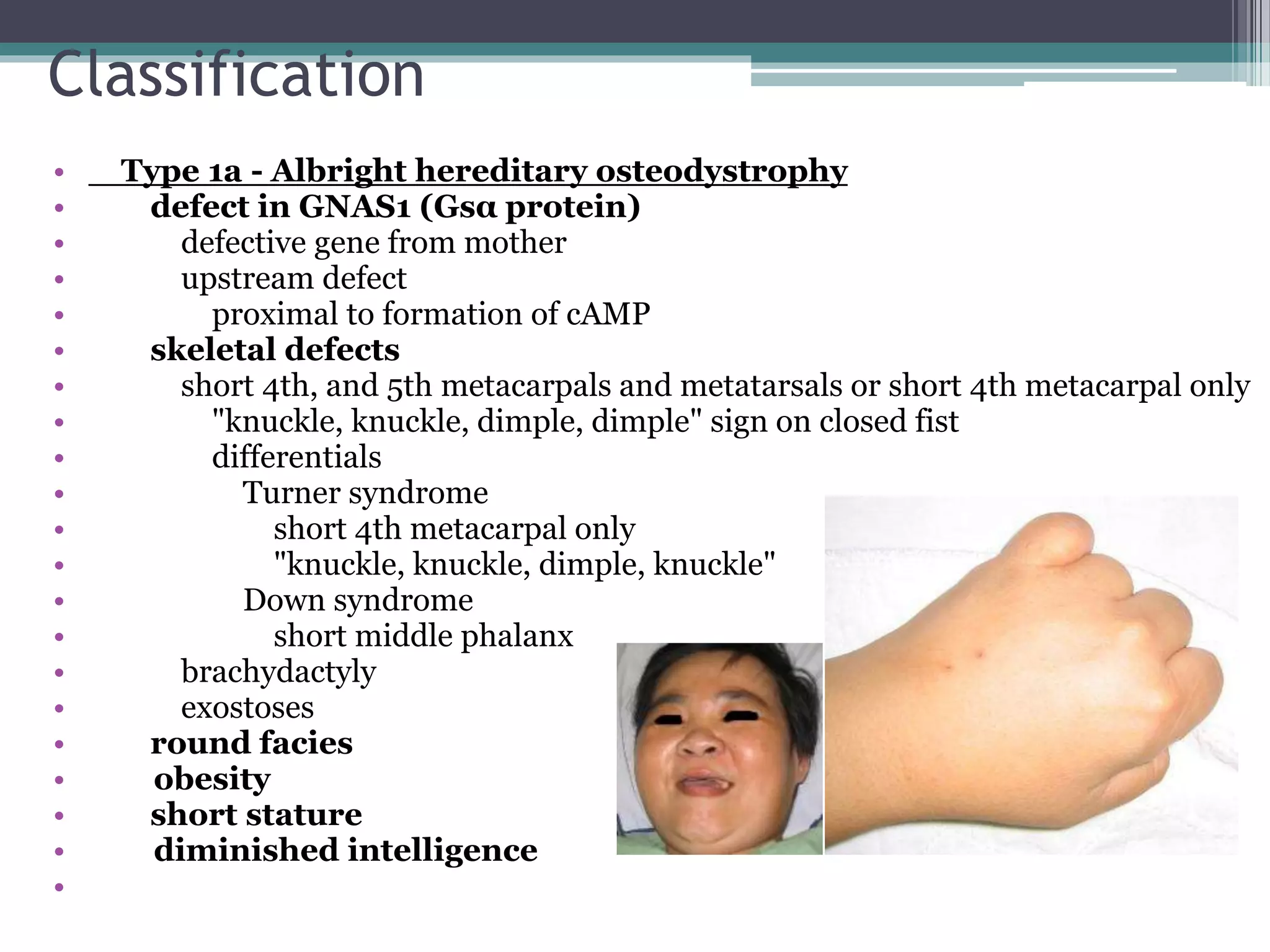 Endocrinology parathyroid gland | PPTX