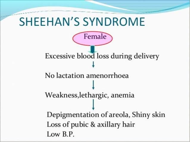 Endocrinology -pituitary gland
