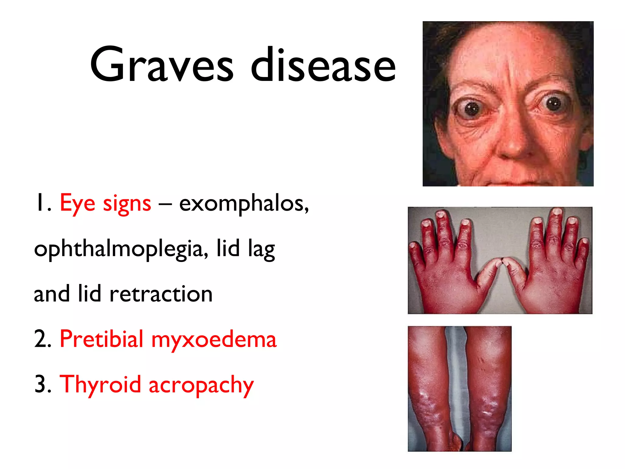 Endocrinology Tutorial | PPT