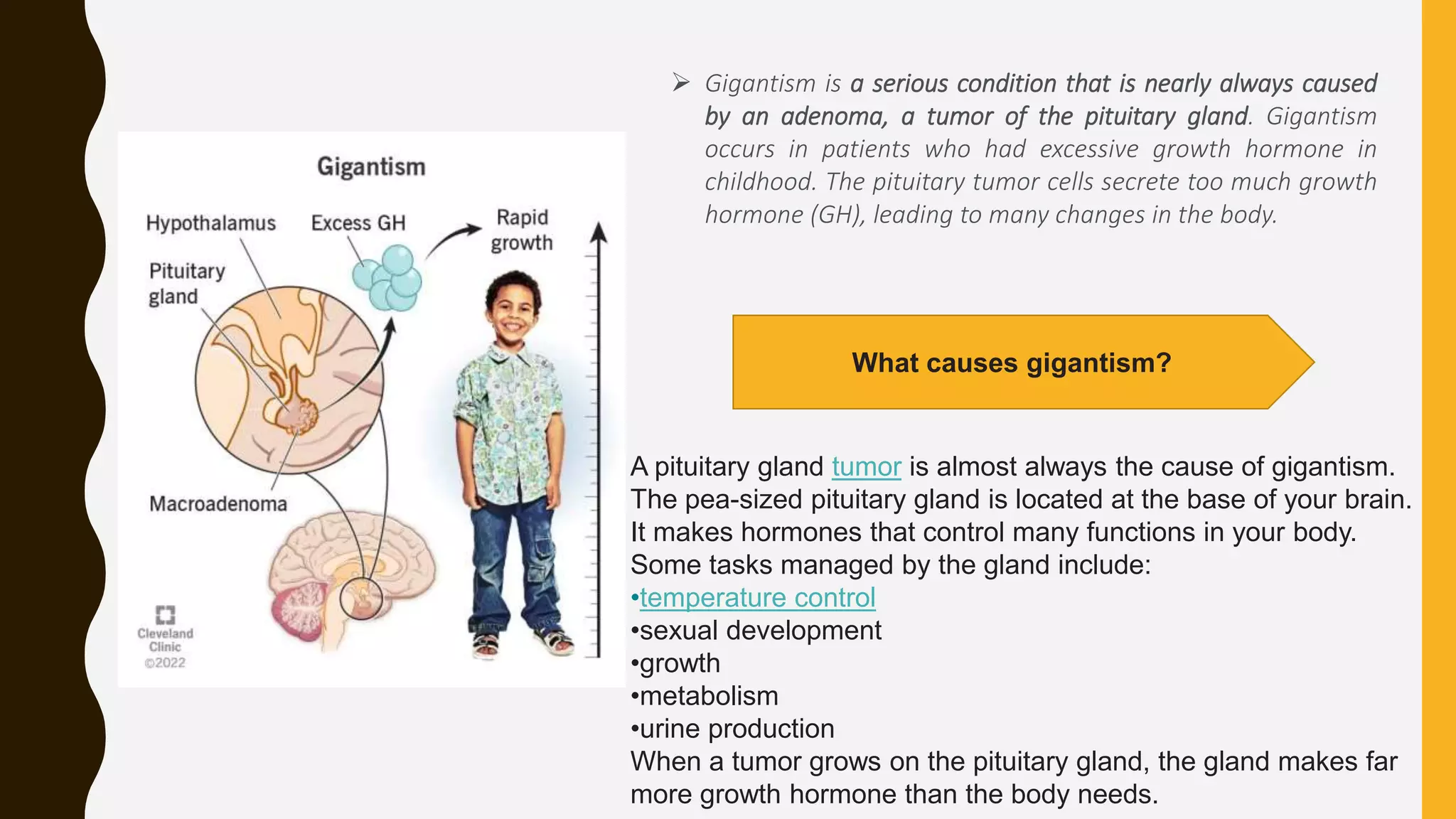 Endocrinology diseases.pptx