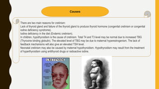 Endocrinology diseases.pptx