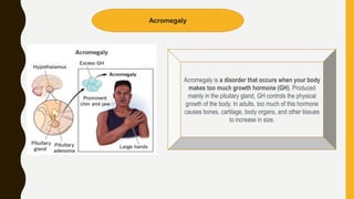 Endocrinology diseases.pptx