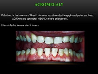 Endocrinology part I by Dr. Sookun Rajeev Kumar | PPT