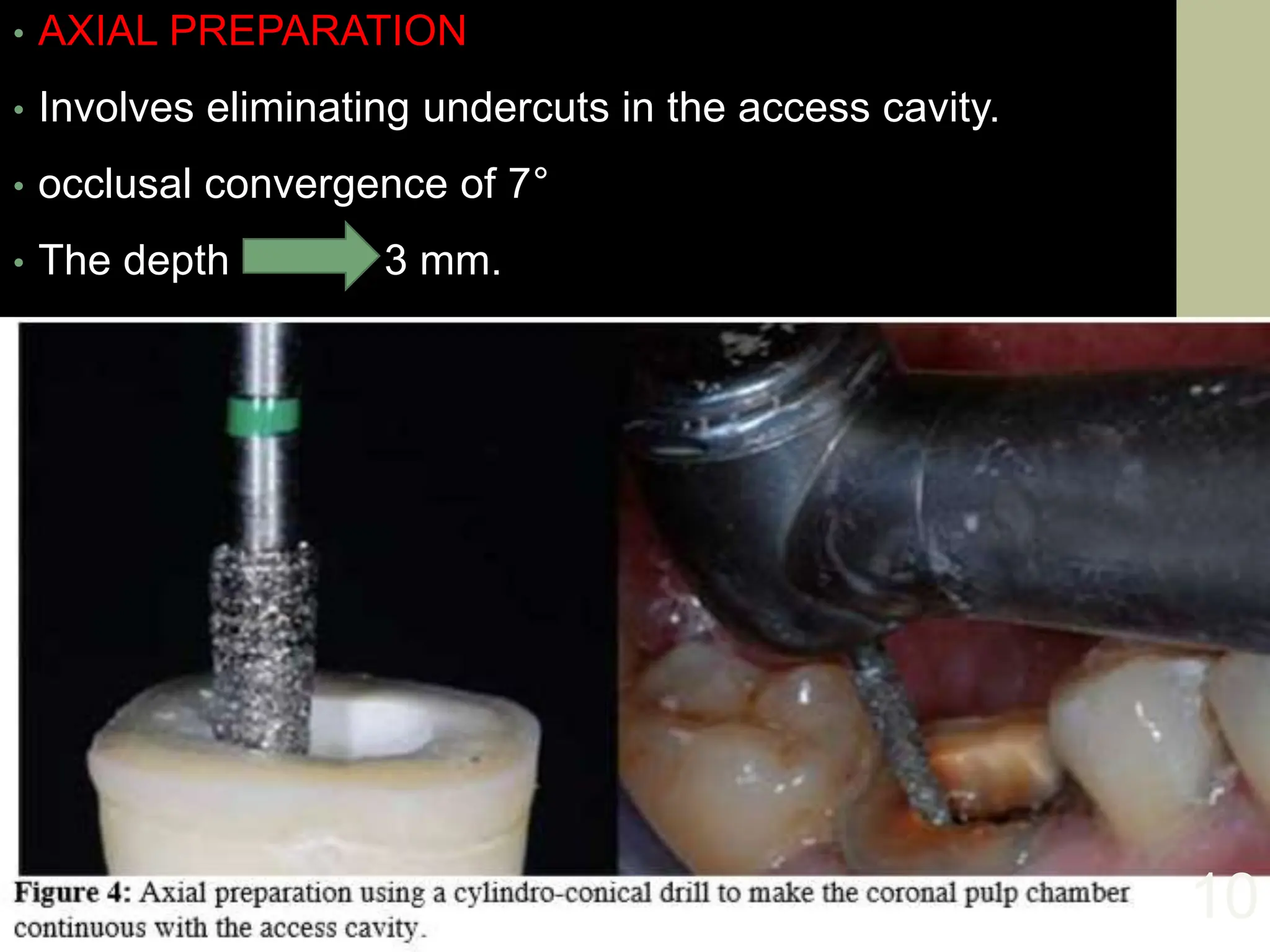 endocrown.pptx............................. | PPTX