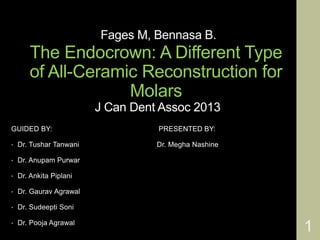 endocrown.pptx............................. | PPTX