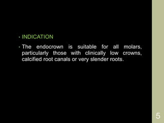 endocrown.pptx............................. | PPTX