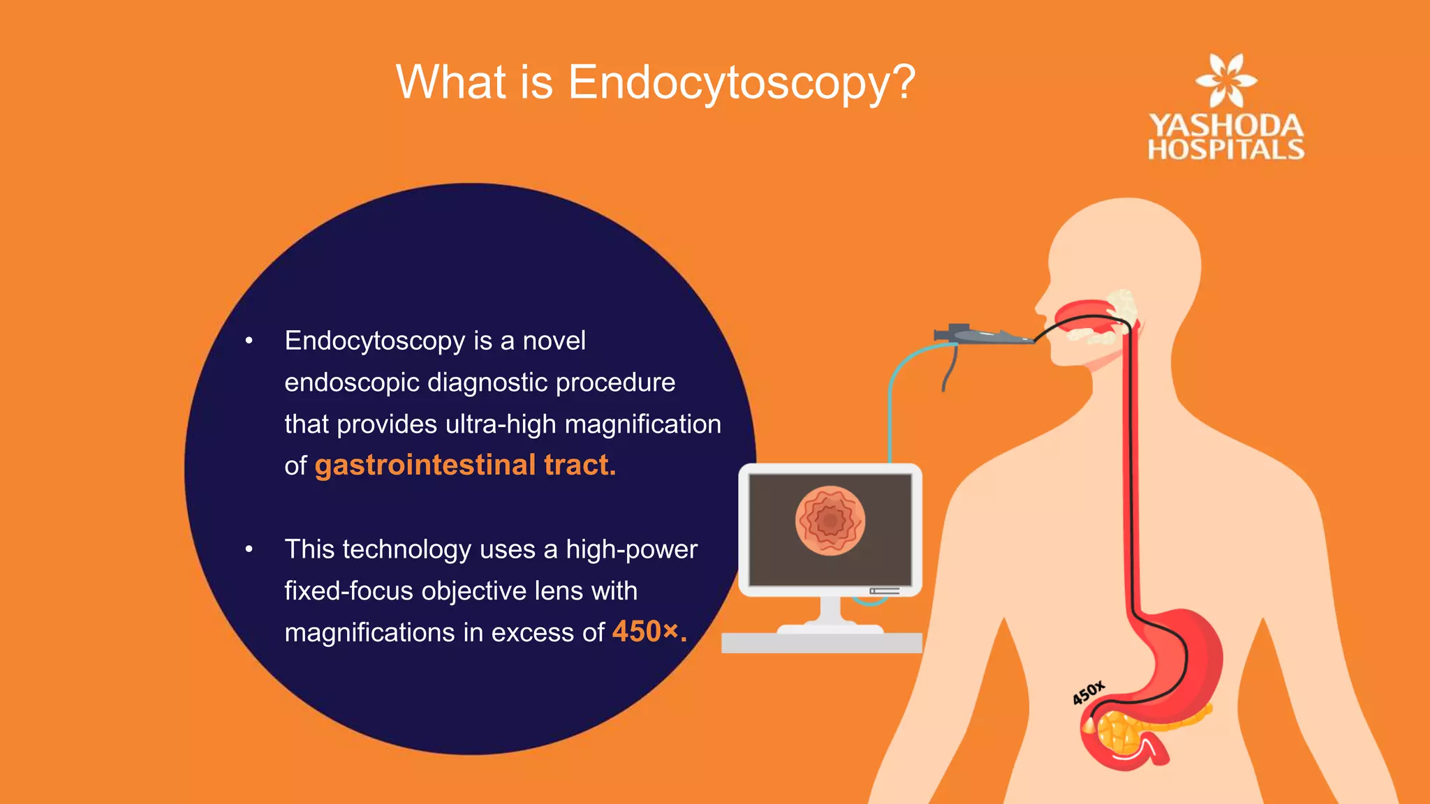 Endocytoscopy Procedure | PPTX | Surgery | Medical Health