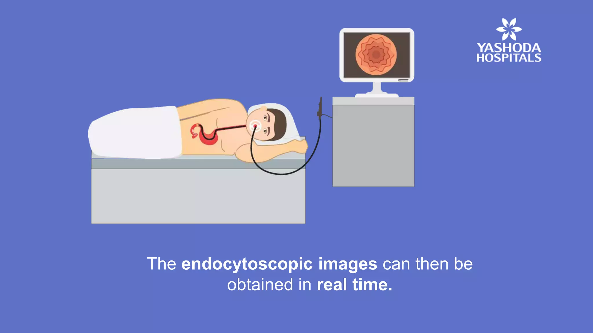 Endocytoscopy Procedure | PPTX | Surgery | Medical Health