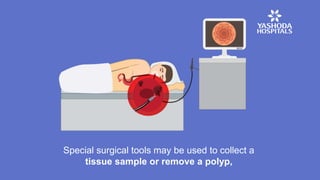 Endocytoscopy Procedure | PPTX | Surgery | Medical Health