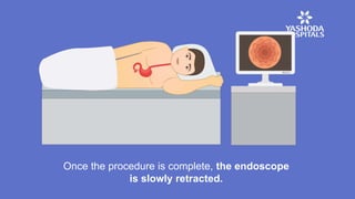Endocytoscopy Procedure | PPTX | Surgery | Medical Health
