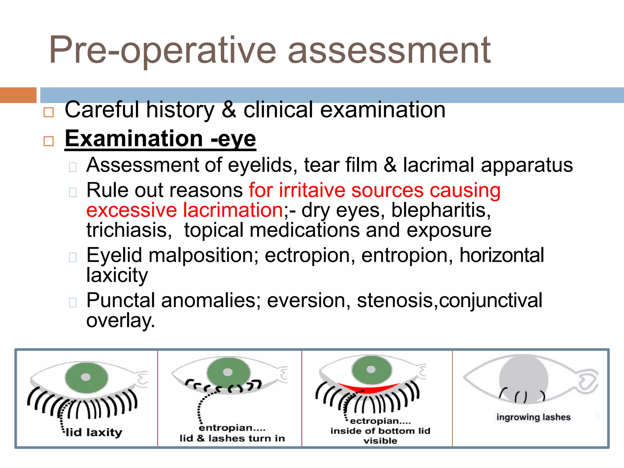 Endoscopic DCR | PPTX