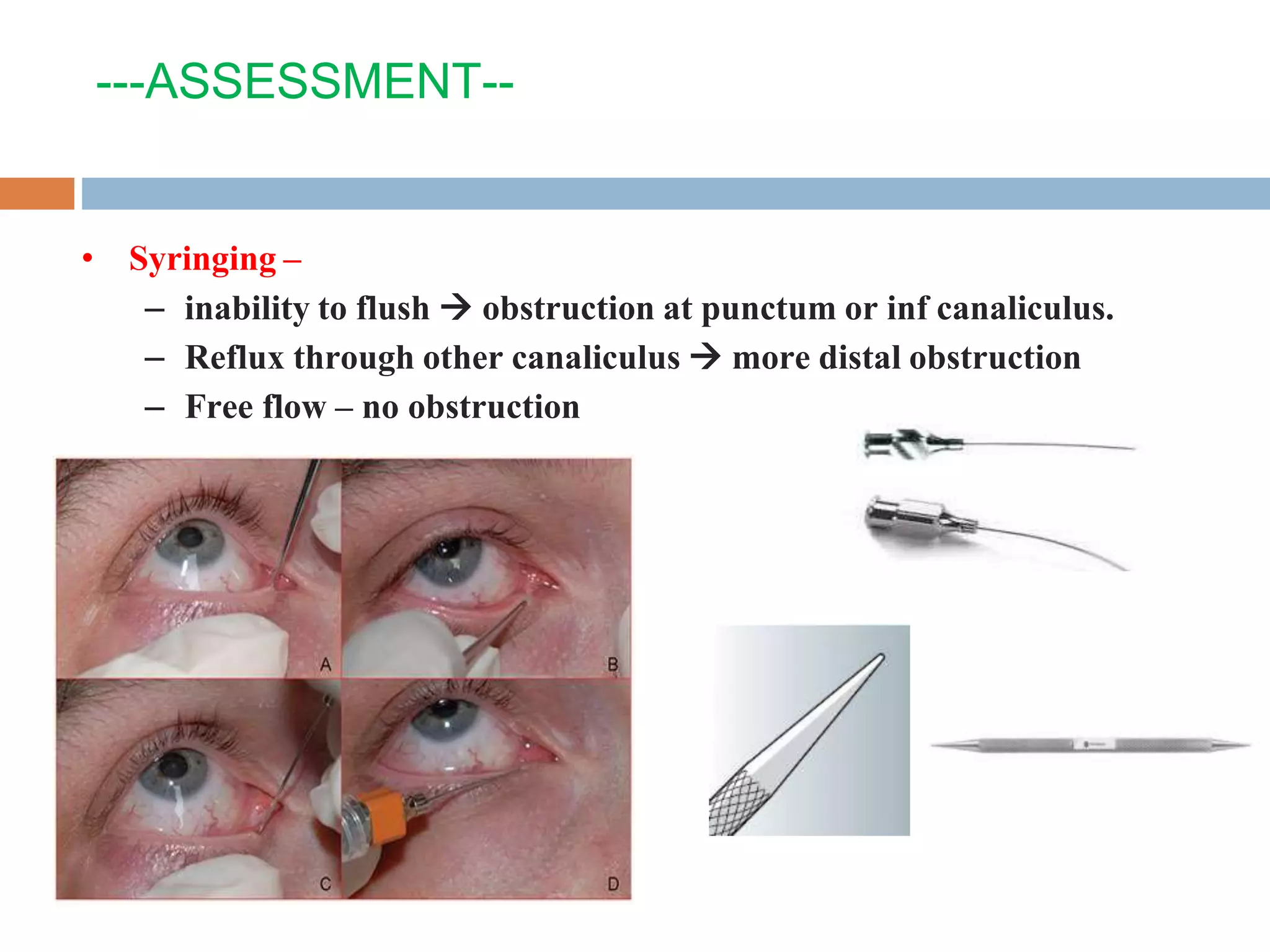 Endoscopic DCR | PPTX